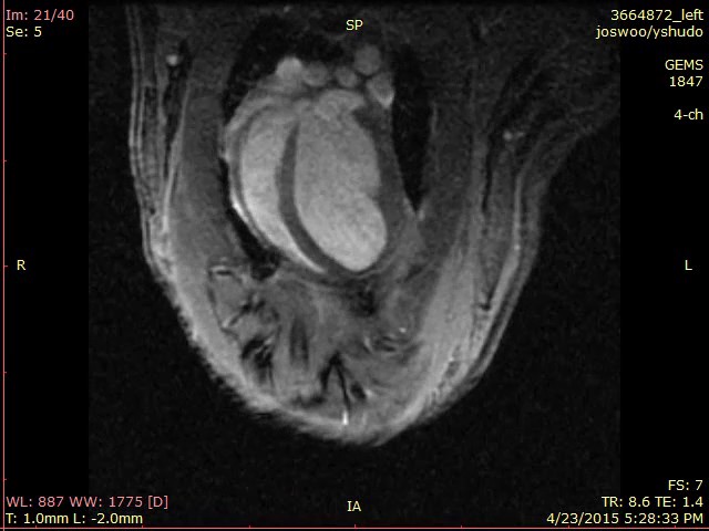 Cardiac MRI of an animal that has undergone photosynthetic therapy ...
