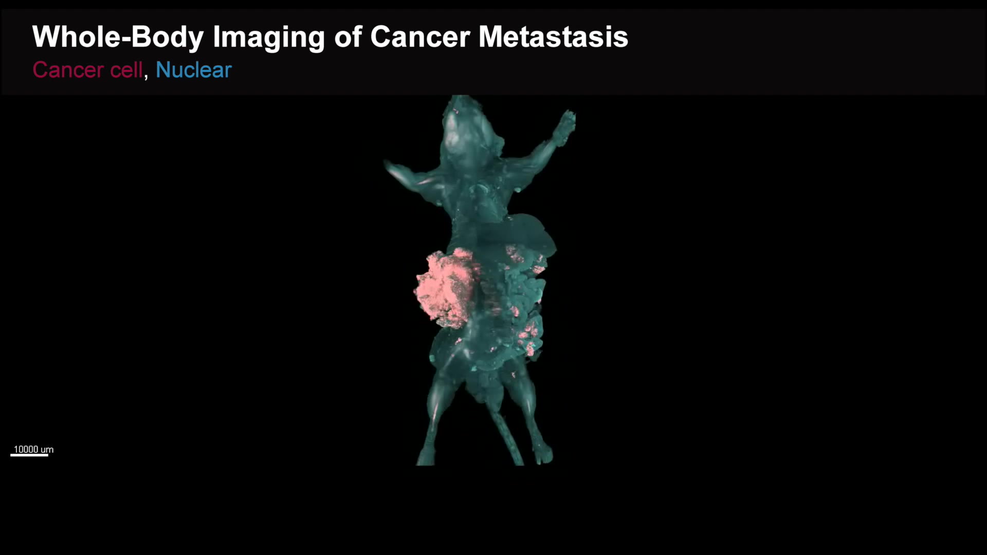 Watching Cancer in Real Time Smithsonian Magazine